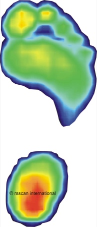 RS Scan – Podotherapiepraktijk Basting – Goedereede